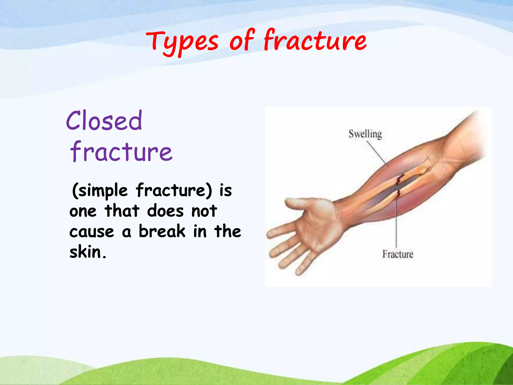 FRACTURE (TYPES AND PATTERN) | PPTX