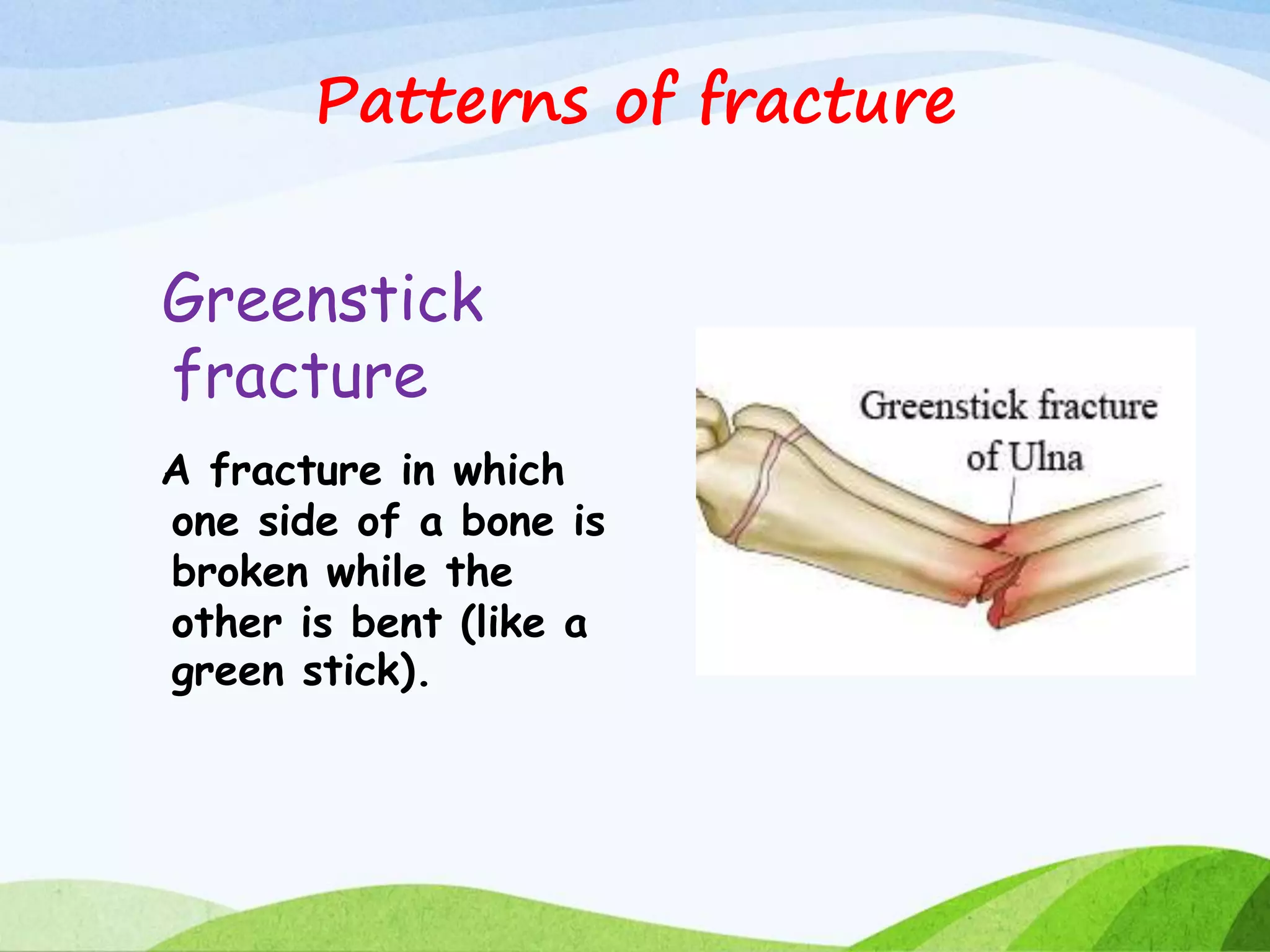 FRACTURE (TYPES AND PATTERN) | PPTX