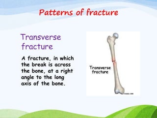 FRACTURE (TYPES AND PATTERN) | PPTX