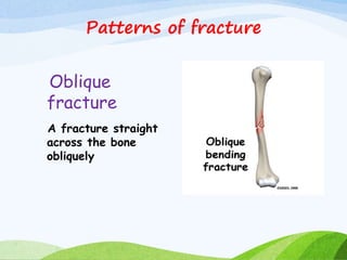 FRACTURE (TYPES AND PATTERN) | PPTX