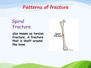 FRACTURE (TYPES AND PATTERN) | PPTX