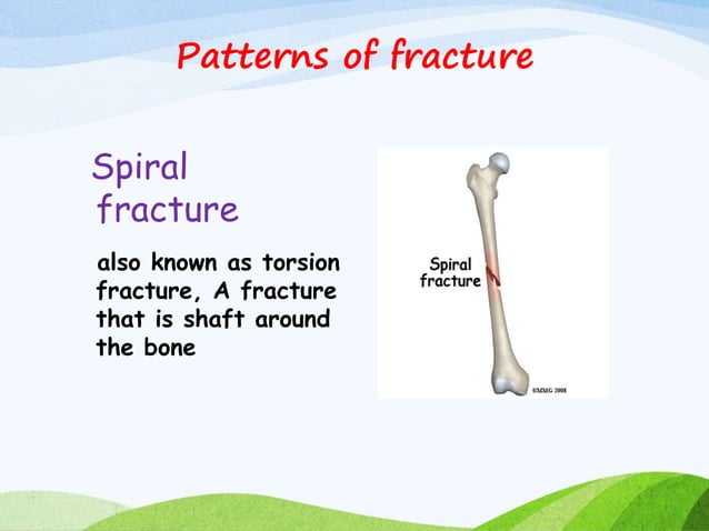 FRACTURE (TYPES AND PATTERN) | PPTX