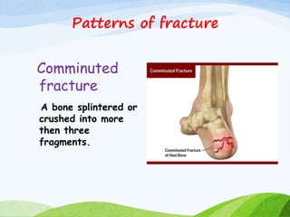 FRACTURE (TYPES AND PATTERN) | PPTX
