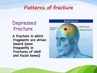 FRACTURE (TYPES AND PATTERN) | PPTX