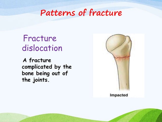 FRACTURE (TYPES AND PATTERN) | PPTX