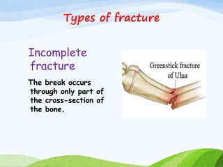 FRACTURE (TYPES AND PATTERN) | PPTX