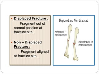 Fracture | PPTX