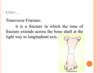 Fracture | PDF