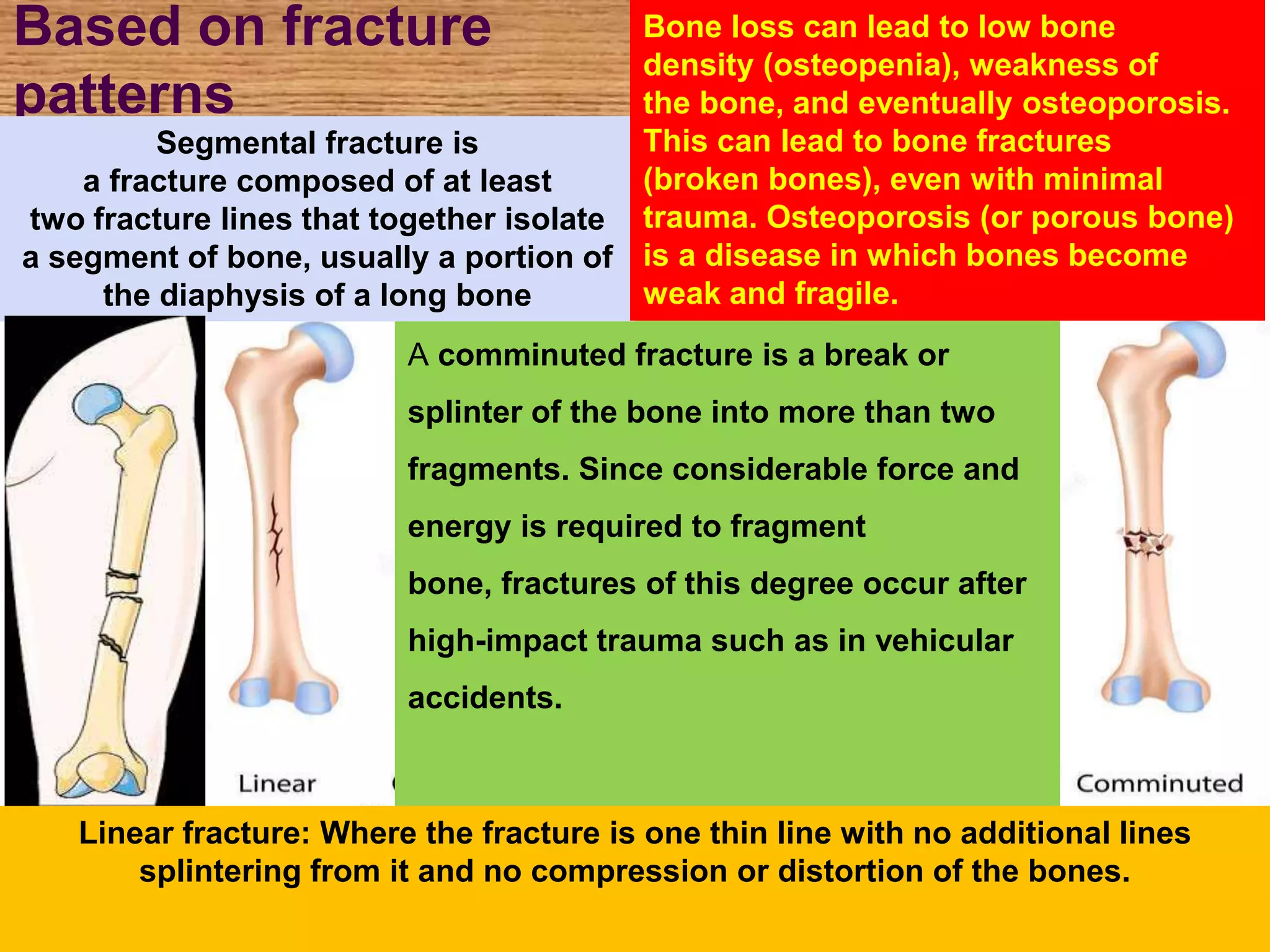 Fracture in children | PPT