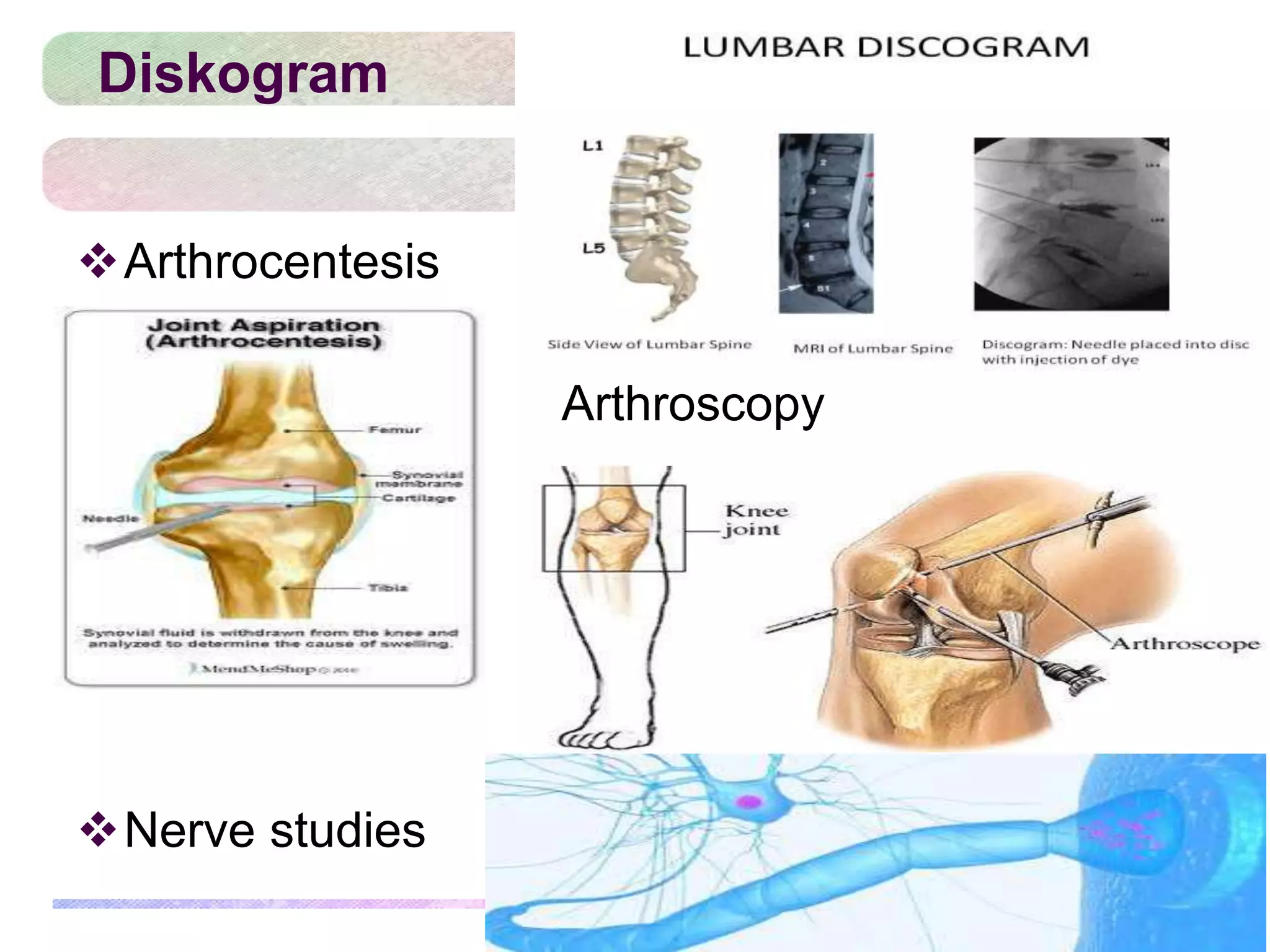 Fracture in children | PPT