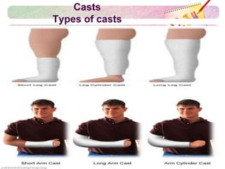 Fracture in children | PPT