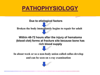 Fracture in children | PPT