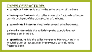 Fracture | PPTX