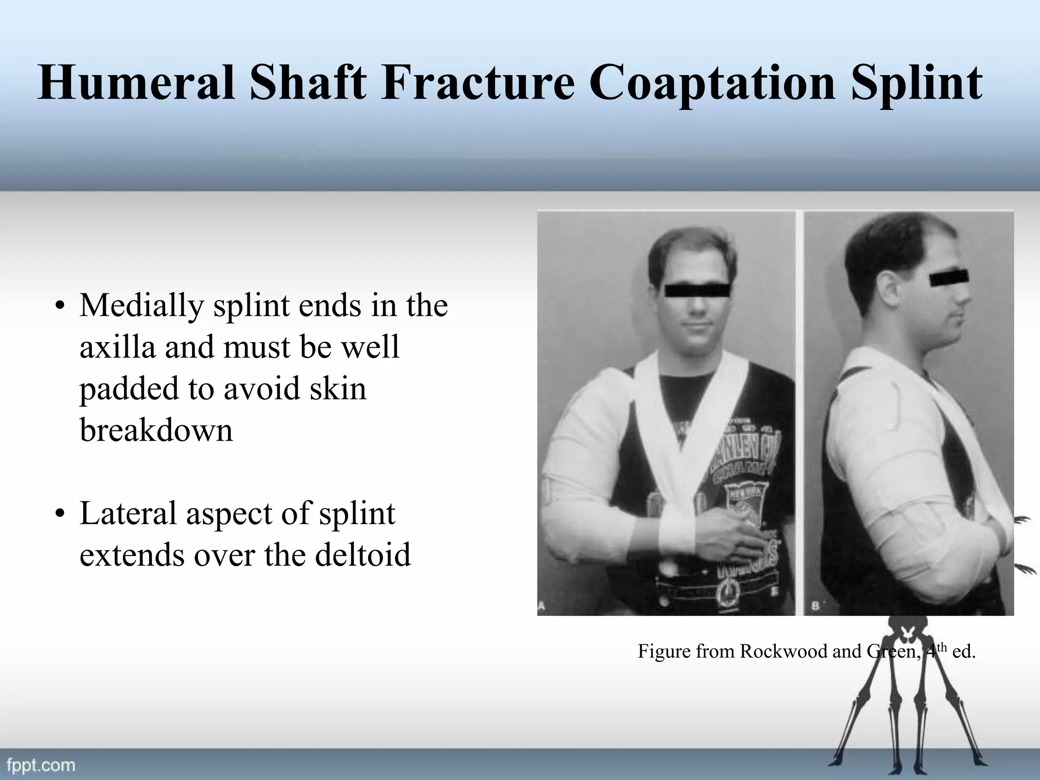 CONSERVATIVE MANAGEMENT OF FRACTURE | PPT