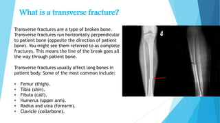 Fracture.pptx