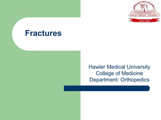 fracture.pptx
