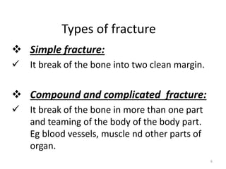 FRACTURE | PPTX