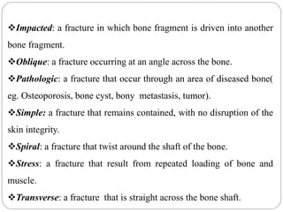FRACTURE.pptx