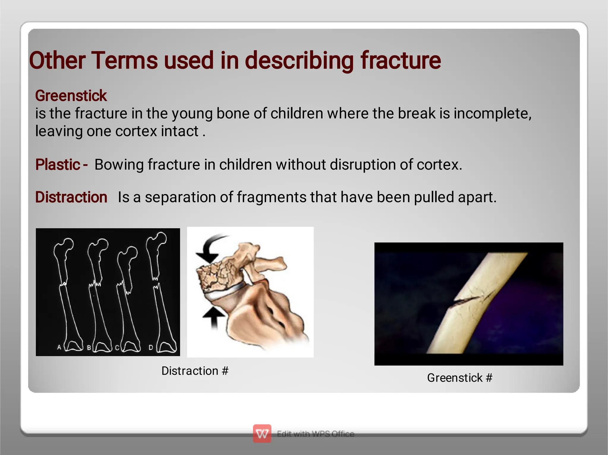 Definition of fracture it's types , symptoms and treatment | PDF