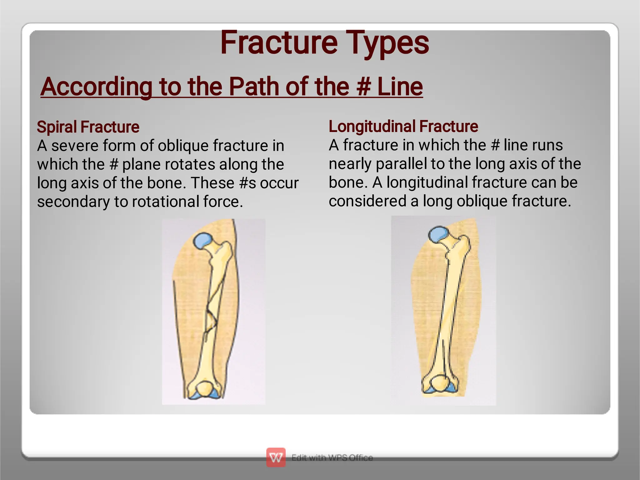 Definition of fracture it's types , symptoms and treatment | PDF