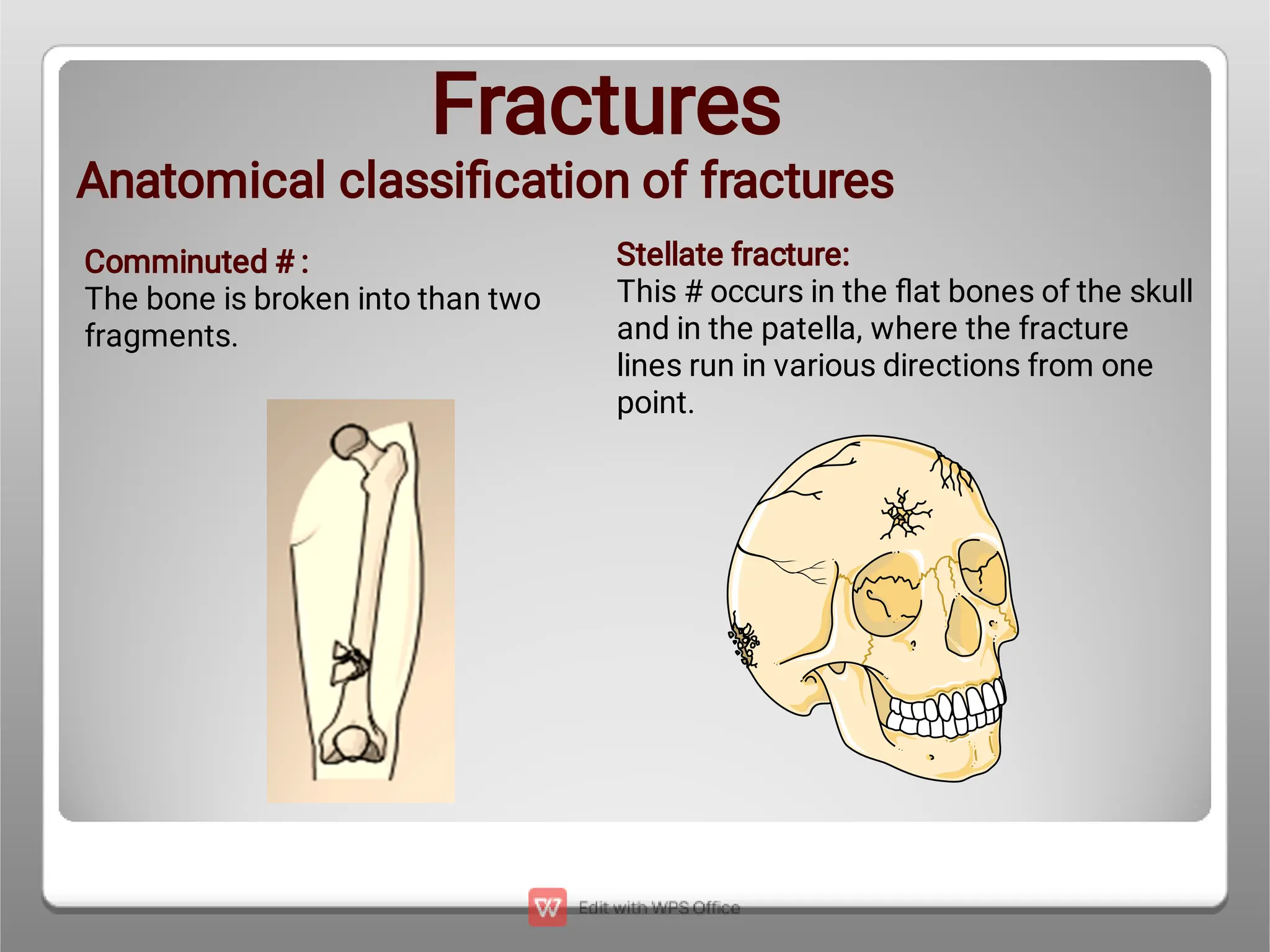 Definition of fracture it's types , symptoms and treatment | PDF
