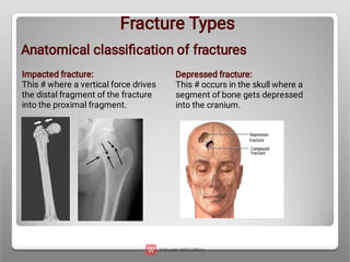 Definition of fracture it's types , symptoms and treatment | PDF