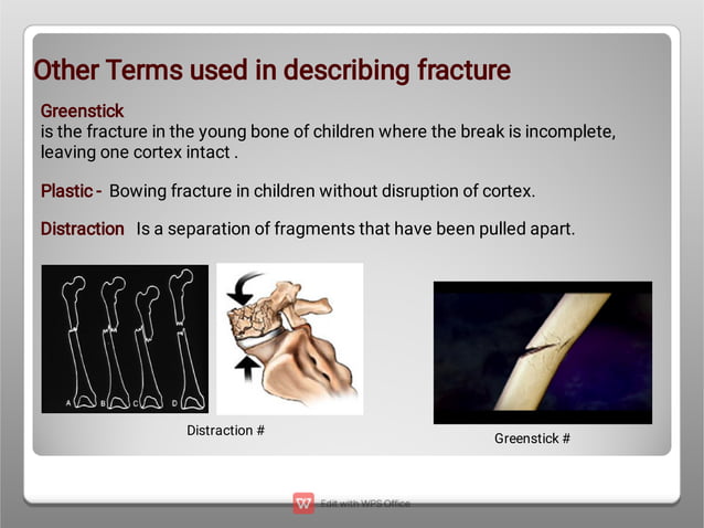 Definition of fracture it's types , symptoms and treatment | PDF