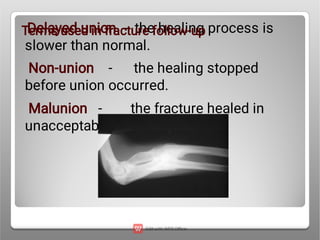 Definition of fracture it's types , symptoms and treatment | PDF