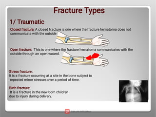 Definition of fracture it's types , symptoms and treatment | PDF