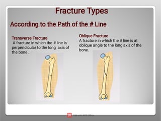 Definition of fracture it's types , symptoms and treatment | PDF