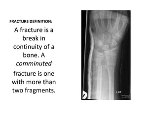FRACTURE AND DISLOCATION FOR BHMS STUDIENTS | PPT