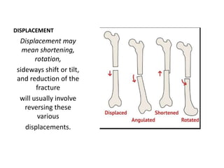 FRACTURE AND DISLOCATION FOR BHMS STUDIENTS | PPT
