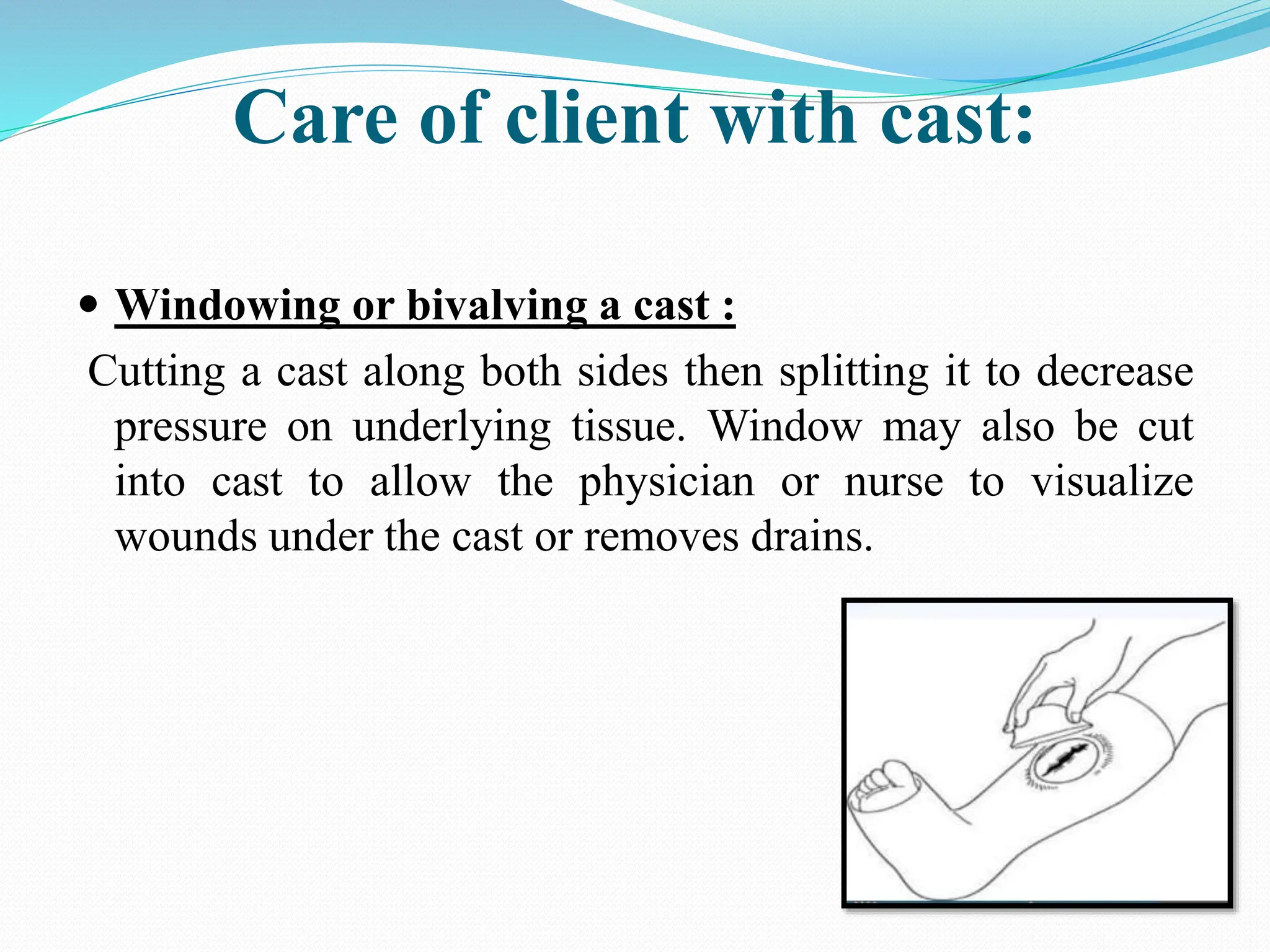 FRACTURE PPT (ORTHOPAEDIC) ALL BASIC INFORMATION | PPTX