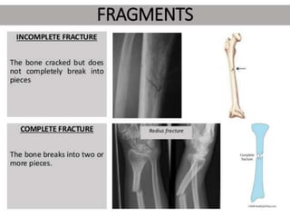 FRACTURE PPT (ORTHOPAEDIC) ALL BASIC INFORMATION | PPTX