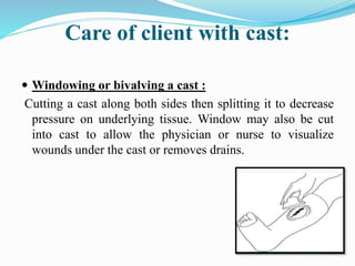 FRACTURE PPT (ORTHOPAEDIC) ALL BASIC INFORMATION | PPTX