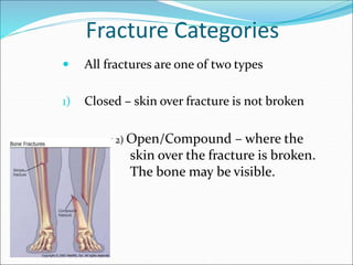 FRACTURE.ptDrJallohamaduscsmakambomakeni | PPT