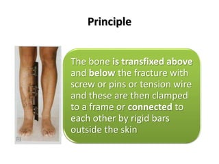 fracture management and reduction and its management | PPTX