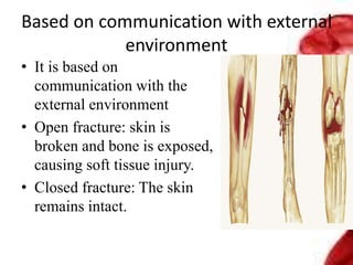 fracture management and reduction and its management | PPTX