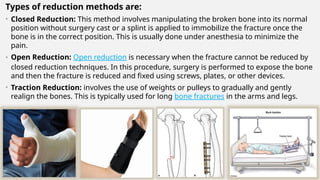 FRACTURE.pptx FIRST AID MANAGEMENT NOTES | PPTX