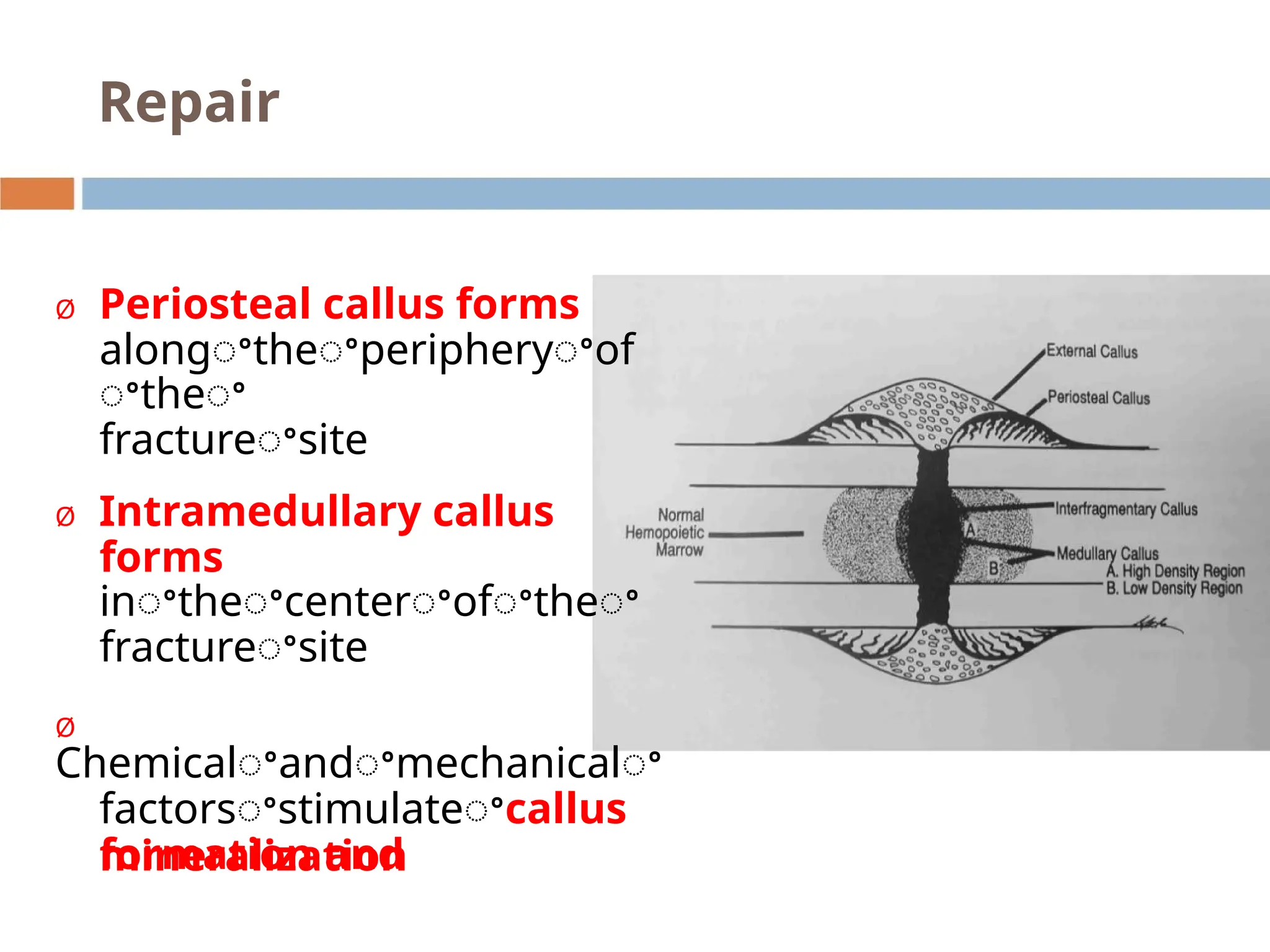 Fracture.ppt full and clear power point for fracture | PPT