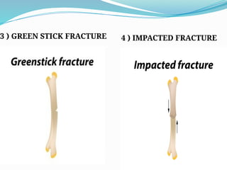 FRACTURE and types of fracture problems .pptx
