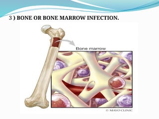 FRACTURE and types of fracture problems .pptx
