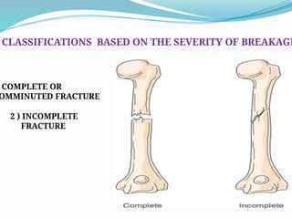FRACTURE and types of fracture problems .pptx