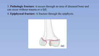 FRACTURE.pptx FOR NURSING STUDENTS CREATED BY KIRAN KARETHA | PPTX