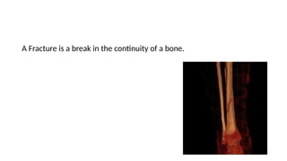 THE INTRODUCTION AND CLASSIFICATION OF THE FRACTURE.pptx