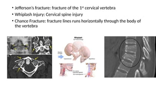 THE INTRODUCTION AND CLASSIFICATION OF THE FRACTURE.pptx