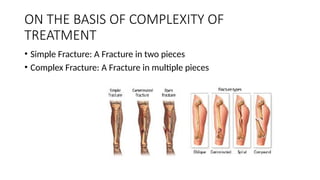 THE INTRODUCTION AND CLASSIFICATION OF THE FRACTURE.pptx