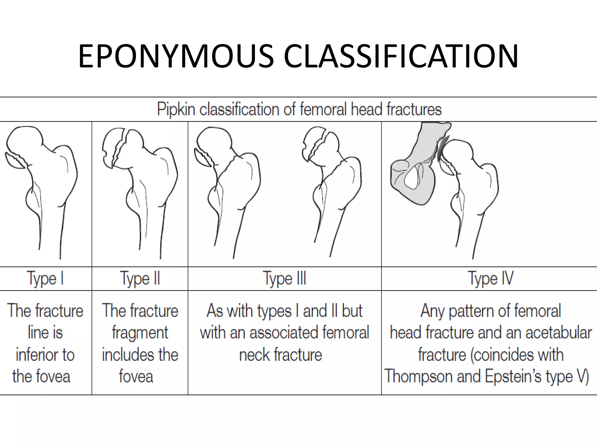 FRACTURE- Aetiology, Classification and Complications.pptx