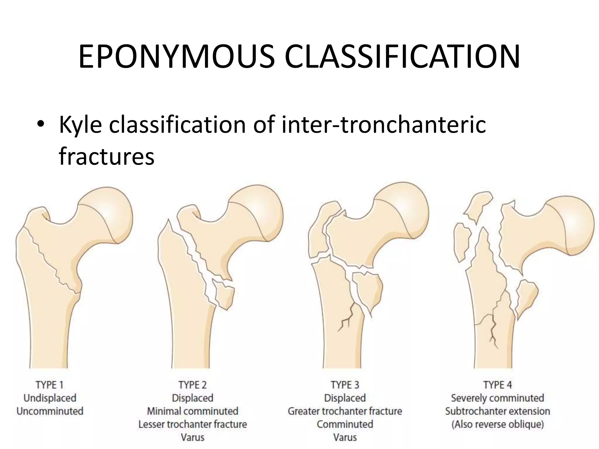 FRACTURE- Aetiology, Classification and Complications.pptx