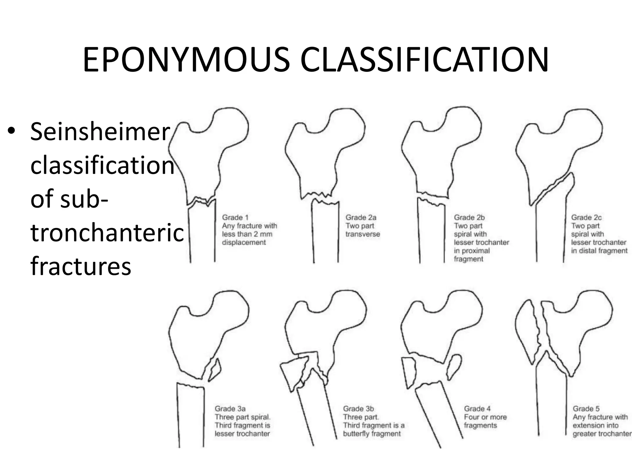 FRACTURE- Aetiology, Classification and Complications.pptx